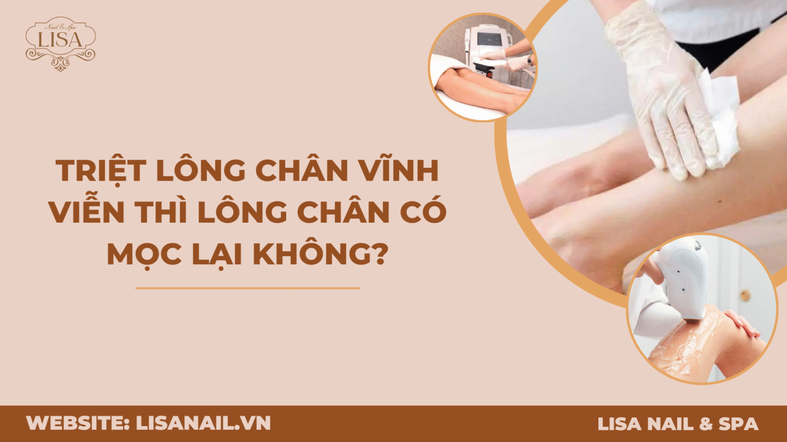 Triệt lông chân vĩnh viễn thì lông chân có mọc lại không?